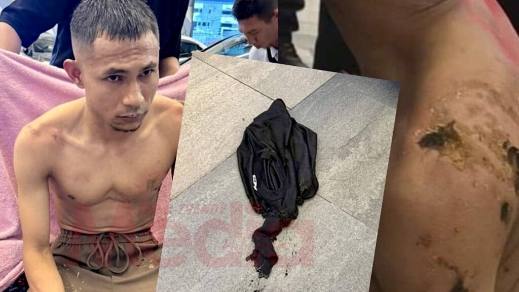 Faisal Halim Cedera Lecur Di Empat Bahagian Tubuh, Suspek Simbah Asid ...
